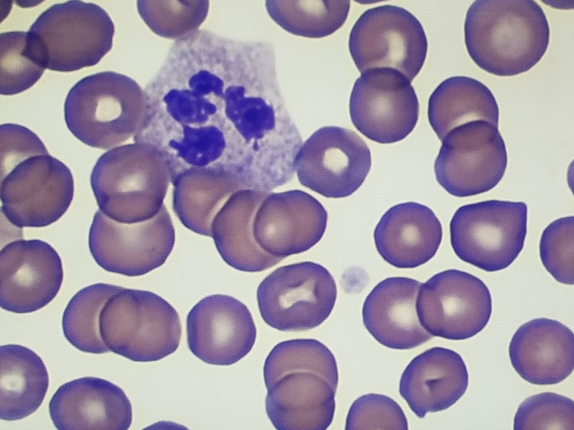 Why Is My Wright's Or Wright-Giemsa Stain Too Blue? • Ethos Biosciences